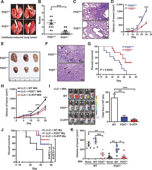 Blocking P2X7-Mediated Macrophage Polarization Overcomes Treatment ...