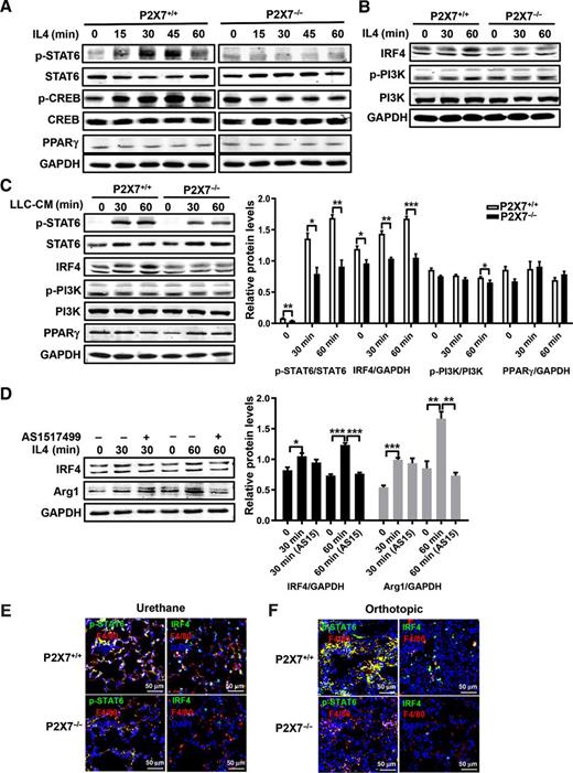 Blocking P2X7-Mediated Macrophage Polarization Overcomes Treatment ...