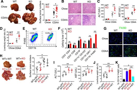 RIPK3 Orchestrates Fatty Acid Metabolism in Tumor-Associated ...