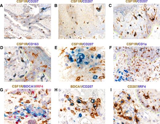 CSF1R Is Required for Differentiation and Migration of Langerhans Cells ...