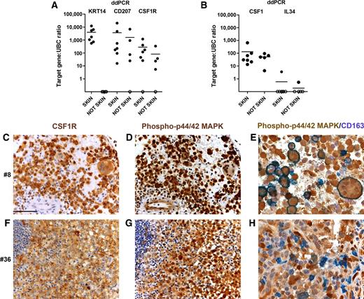 CSF1R Is Required for Differentiation and Migration of Langerhans Cells ...