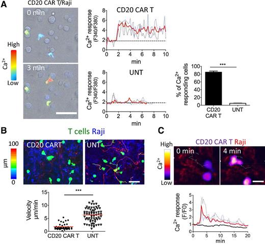 CAR T-cell Entry into Tumor Islets Is a Two-Step Process Dependent on IFNγ and ICAM-1 | Cancer ...