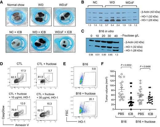 Fructose Promotes Cytoprotection in Melanoma Tumors and Resistance to ...