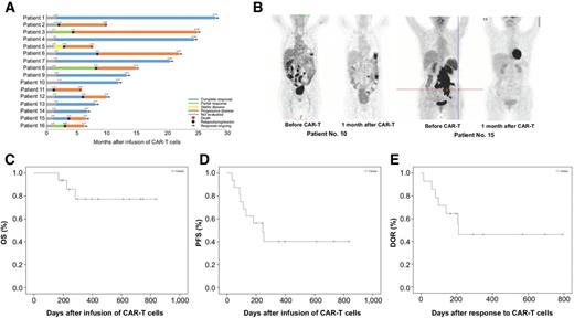 CD19/CD22 Dual-Targeted CAR T-cell Therapy for Relapsed/Refractory Aggressive B-cell Lymphoma: A ...