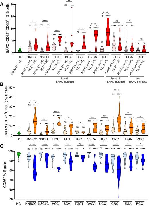 CD86+ Antigen-Presenting B Cells Are Increased in Cancer, Localize in ...