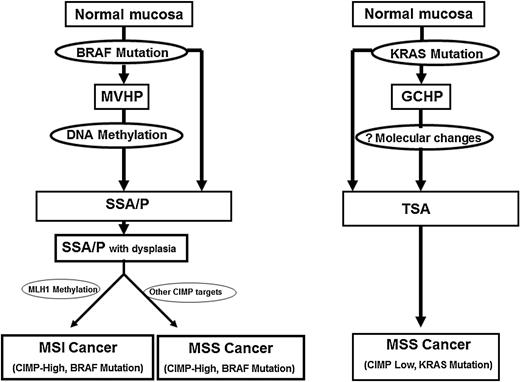 Sessile Serrated Polyps and Colon Cancer Prevention | Cancer Prevention ...