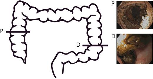 Spatial Variation of the Native Colon Microbiota in Healthy Adults ...
