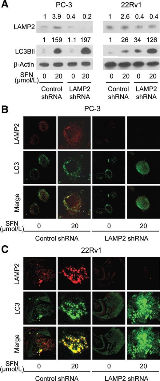 The Role of Lysosome-associated Membrane Protein 2 in Prostate Cancer ...