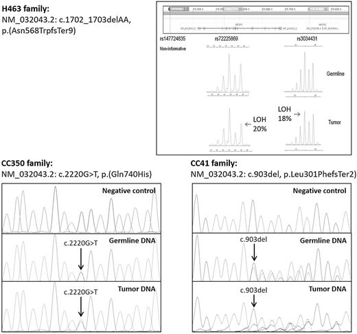 BRIP1, a Gene Potentially Implicated in Familial Colorectal Cancer Type ...