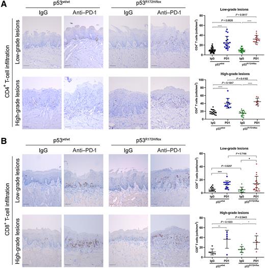 Local Anti–PD-1 Delivery Prevents Progression of Premalignant Lesions ...