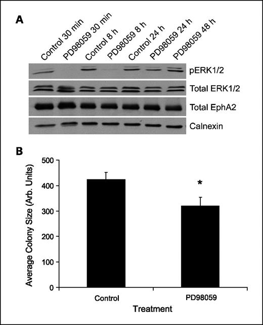 EphA2 in the Early Pathogenesis and Progression of Non–Small Cell Lung ...
