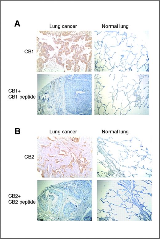 Cannabinoid Receptors, CB1 and CB2, as Novel Targets for Inhibition of ...