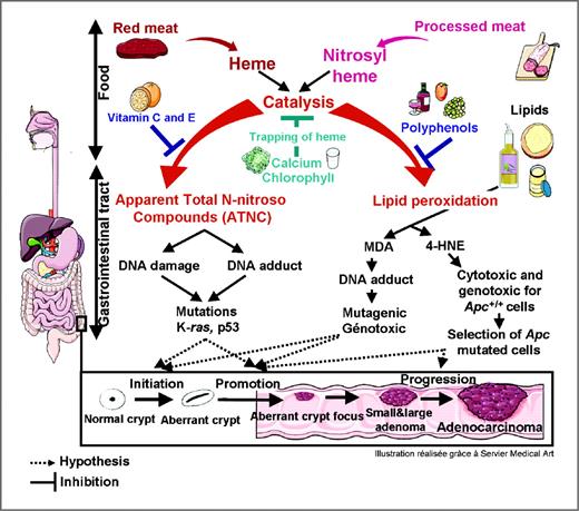 Heme Iron from Meat and Risk of Colorectal Cancer: A Meta-analysis and ...