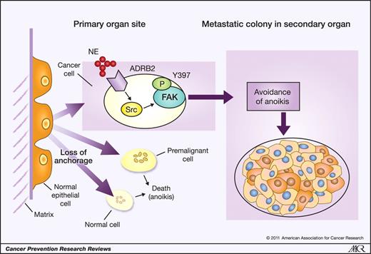 Stress Influences on Anoikis | Cancer Prevention Research | American ...