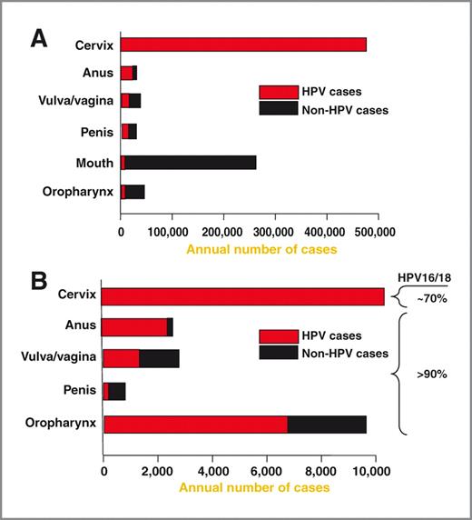 Reducing HPV-Associated Cancer Globally | Cancer Prevention Research ...