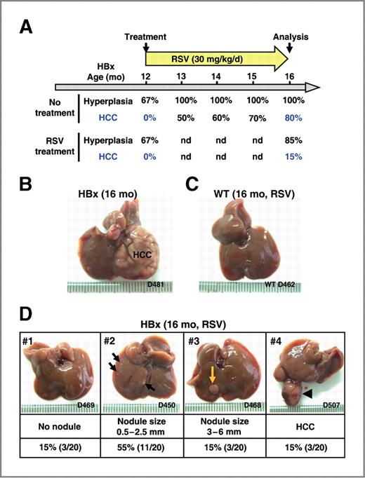 Resveratrol Helps Recovery from Fatty Liver and Protects against ...
