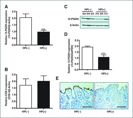 Inhibition of 15-Hydroxyprostaglandin Dehydrogenase by Helicobacter ...