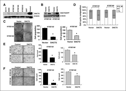 DACT2 Is a Candidate Tumor Suppressor and Prognostic Marker in ...