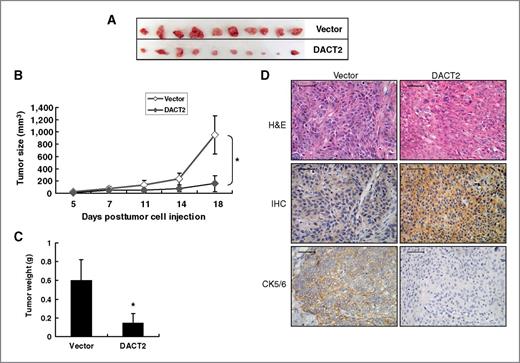 DACT2 Is a Candidate Tumor Suppressor and Prognostic Marker in ...