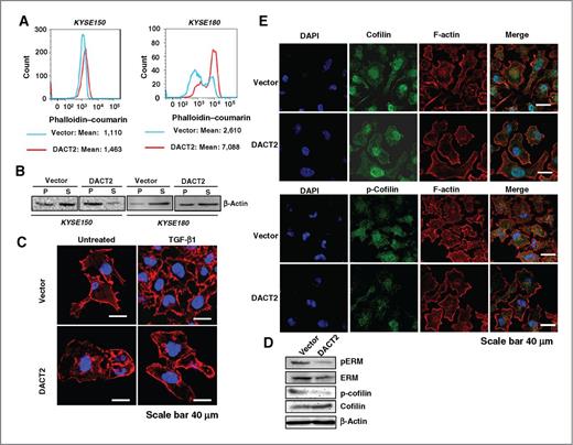 DACT2 Is a Candidate Tumor Suppressor and Prognostic Marker in ...