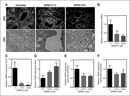 Eflornithine (DFMO) Prevents Progression of Pancreatic Cancer by ...