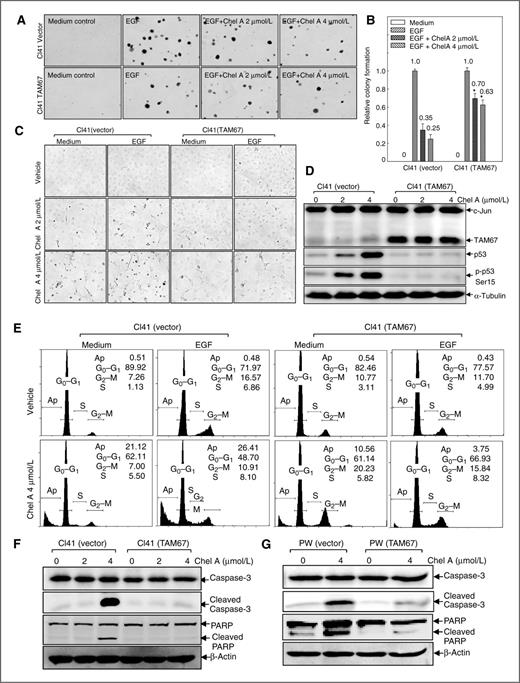 Crucial Role of c-Jun Phosphorylation at Ser63/73 Mediated by PHLPP ...