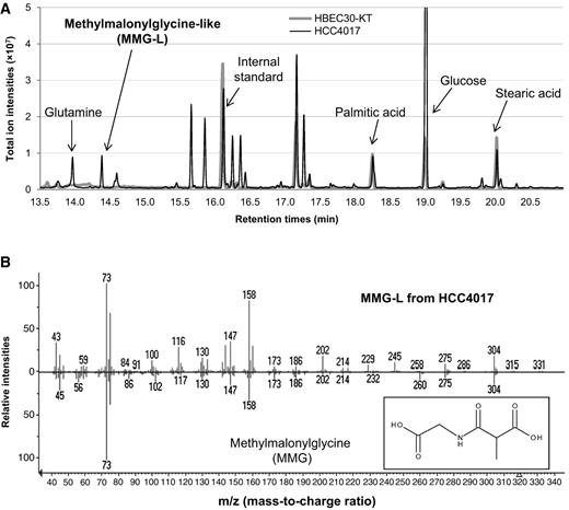 Cancer-Specific Production of N-Acetylaspartate via NAT8L Overexpression in Non–Small Cell Lung ...