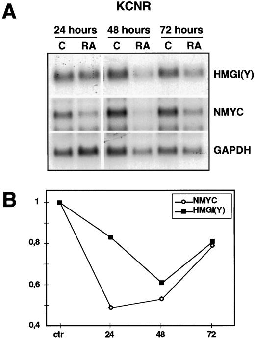HMGI(Y) and HMGI-C Genes Are Expressed in Neuroblastoma Cell Lines and ...