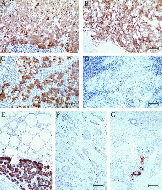 Bone Morphogenetic Protein-6 Is a Marker of Serous Acinar Cell ...
