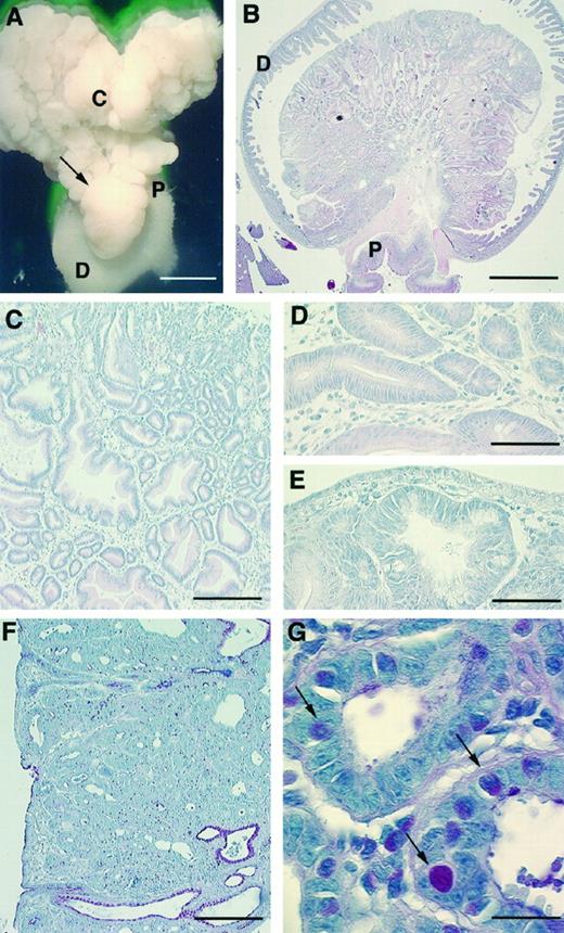 Gastric and Duodenal Polyps in Smad4 (Dpc4) Knockout Mice1 | Cancer ...