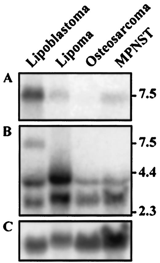 PLAG1 Fusion Oncogenes in Lipoblastoma1 | Cancer Research | American ...