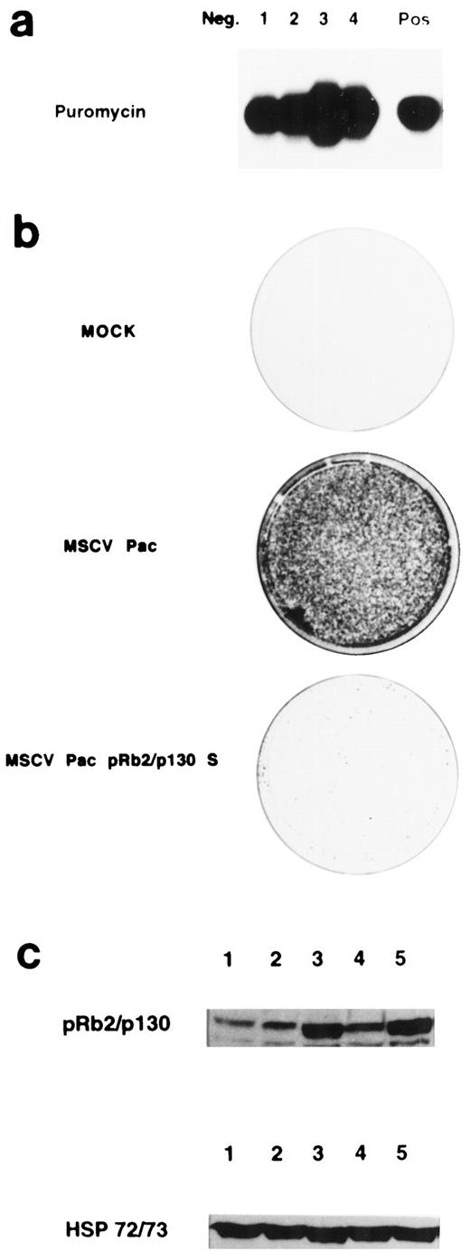 Mutations in the Retinoblastoma-related Gene RB2/p130 in Lung Tumors ...