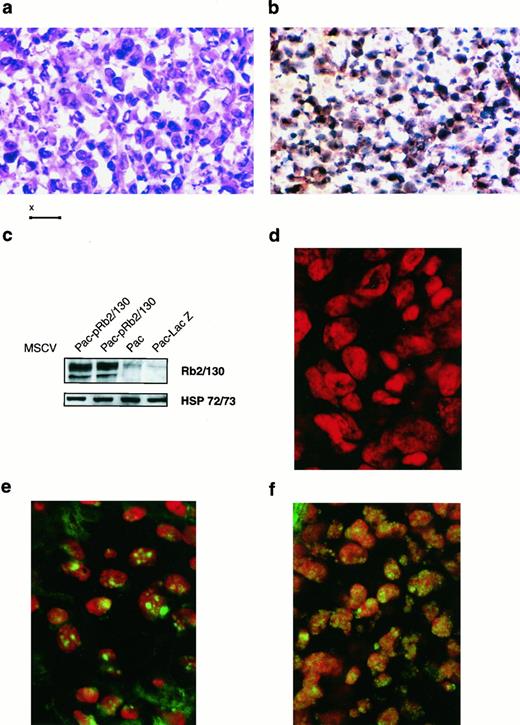 Mutations in the Retinoblastoma-related Gene RB2/p130 in Lung Tumors ...