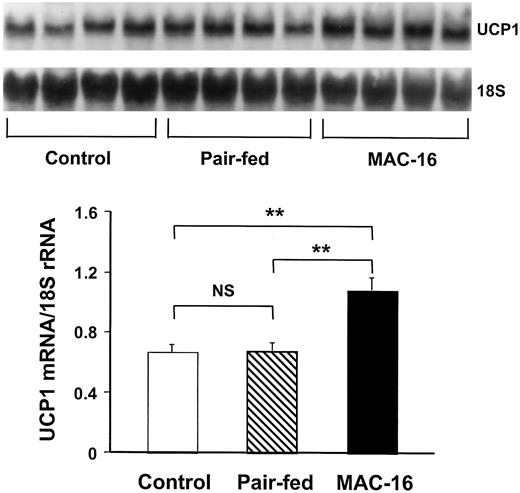Increased Gene Expression of Brown Fat Uncoupling Protein (UCP)1 and ...