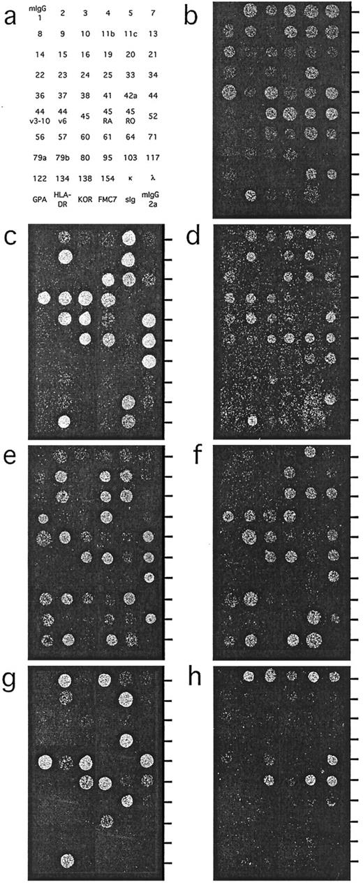 Immunophenotyping of Leukemias Using a Cluster of Differentiation ...