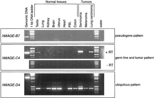 An Overview of the MAGE Gene Family with the Identification of All ...