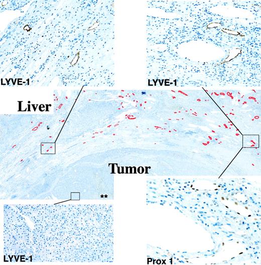 LYVE-1 Is Not Restricted to the Lymph Vessels | Cancer Research ...