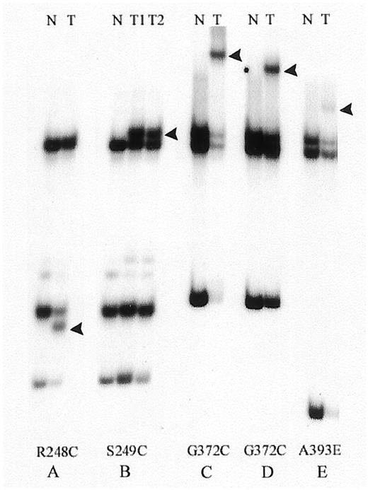 The Fibroblast Growth Factor Receptor 3 (FGFR3) Mutation Is a Strong ...