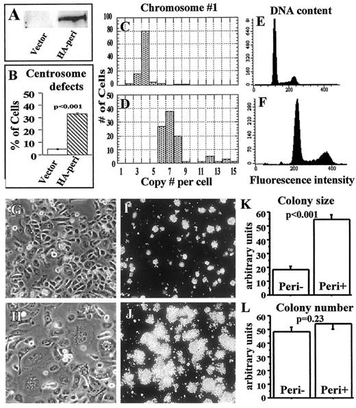 Centrosome Defects Can Account for Cellular and Genetic Changes That ...