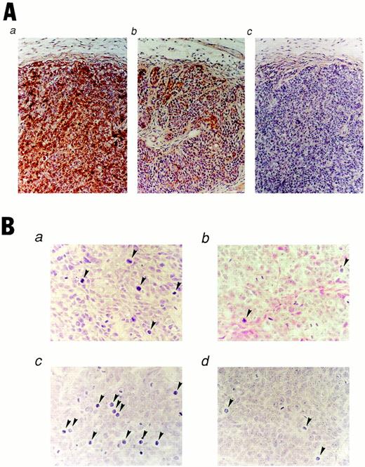 Suppression of a Squamous Cell Carcinoma (SCC)-related Serpin, SCC ...