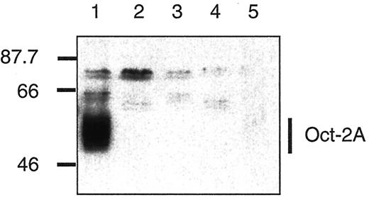 Oct-2 and Bob-1 Deficiency in Hodgkin and Reed Sternberg Cells1 ...