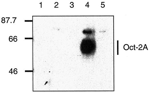 Oct-2 and Bob-1 Deficiency in Hodgkin and Reed Sternberg Cells1 ...