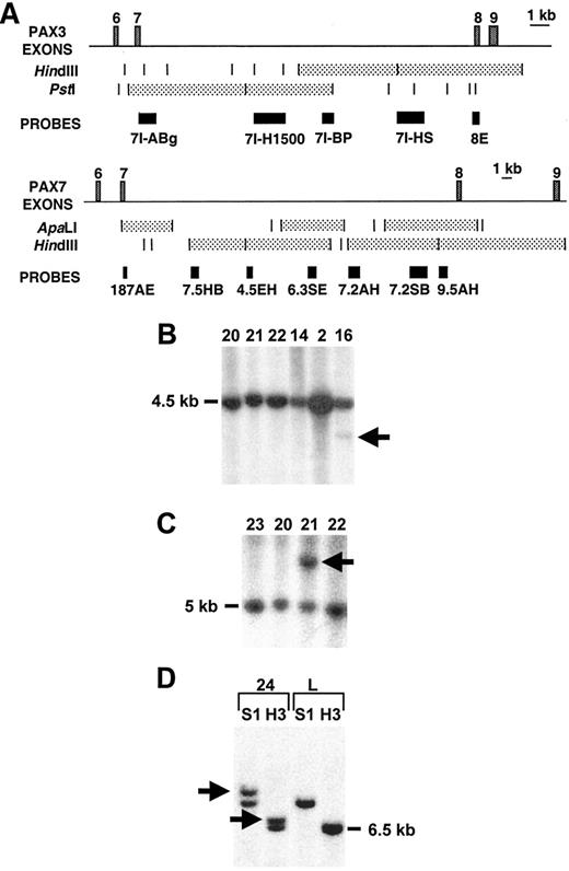 Genetic Heterogeneity in the Alveolar Rhabdomyosarcoma Subset without ...