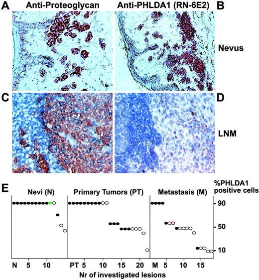 Identification of the Human PHLDA1/TDAG51 Gene | Cancer Research ...