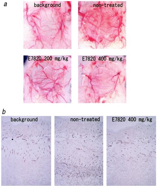 Sulfonamide Derivative, E7820, Is a Unique Angiogenesis Inhibitor ...