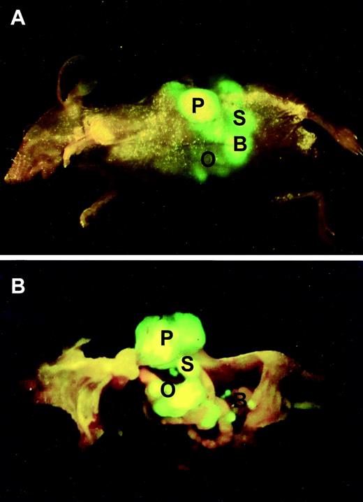 Real-Time Optical Imaging of Primary Tumor Growth and Multiple ...
