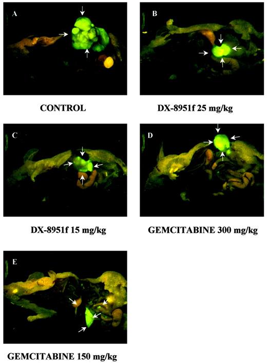 Efficacy of Camptothecin Analog DX-8951f (Exatecan Mesylate) on Human ...