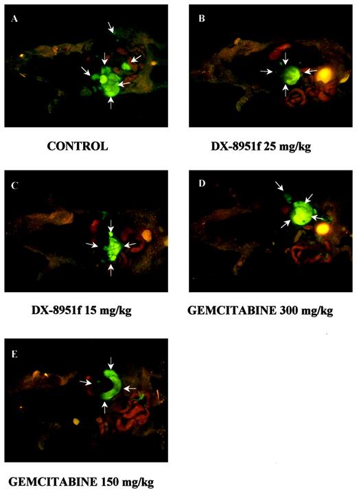 Efficacy of Camptothecin Analog DX-8951f (Exatecan Mesylate) on Human ...