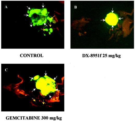 Efficacy of Camptothecin Analog DX-8951f (Exatecan Mesylate) on Human ...