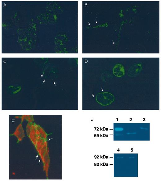 Overexpression of Legumain in Tumors Is Significant for Invasion ...